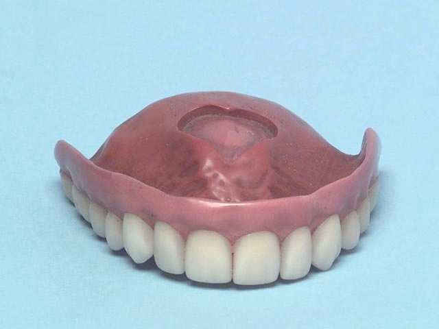 Protes - Landskrona museum / DigitaltMuseum