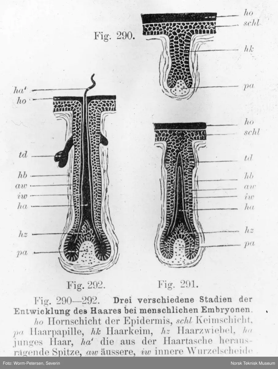 J.O. Hennum: Anatomi (Hud og haar) - Norsk Teknisk Museum / DigitaltMuseum